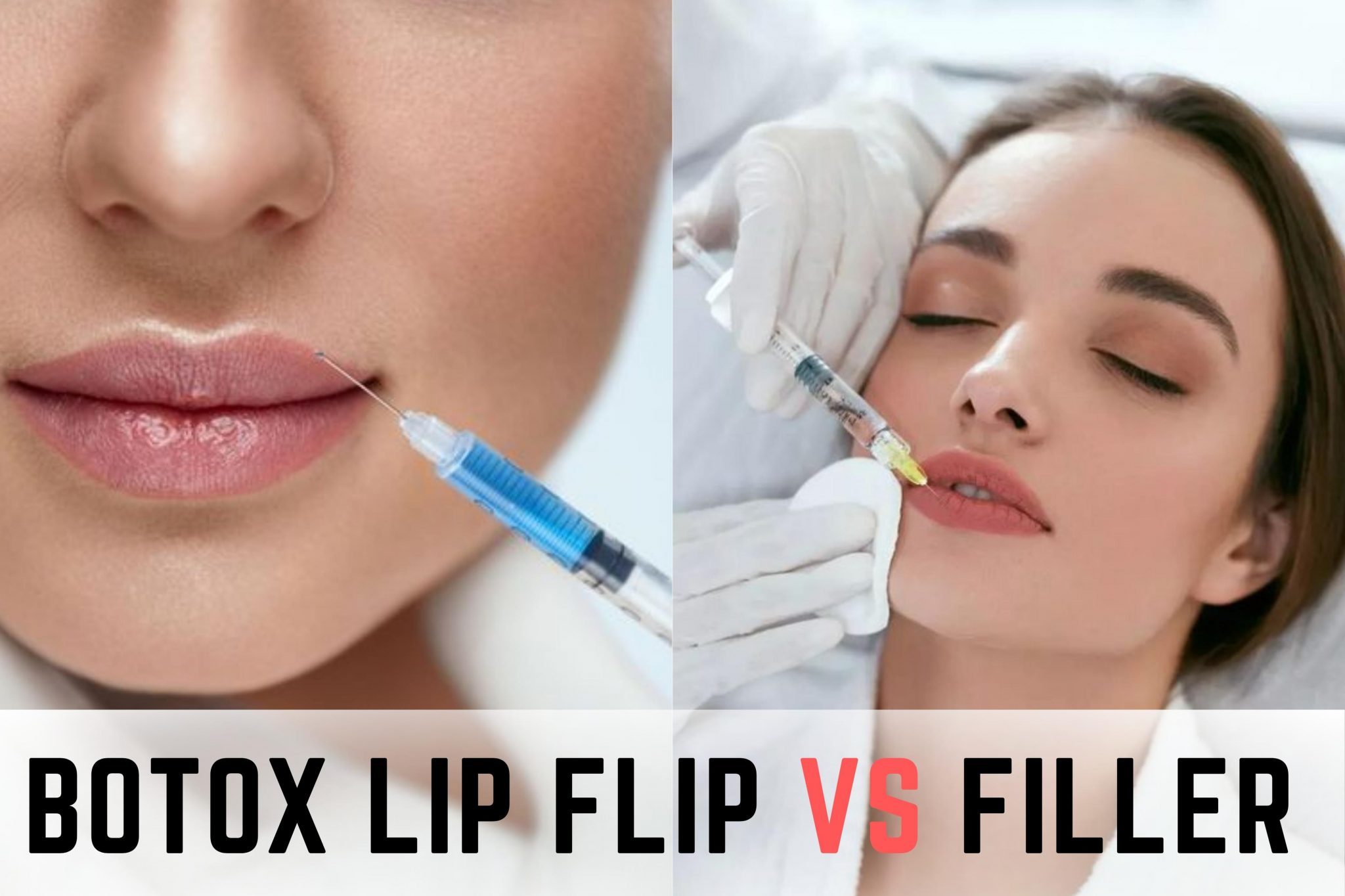 Botox Lip Flip Vs Filler - Fitness Beauty Art