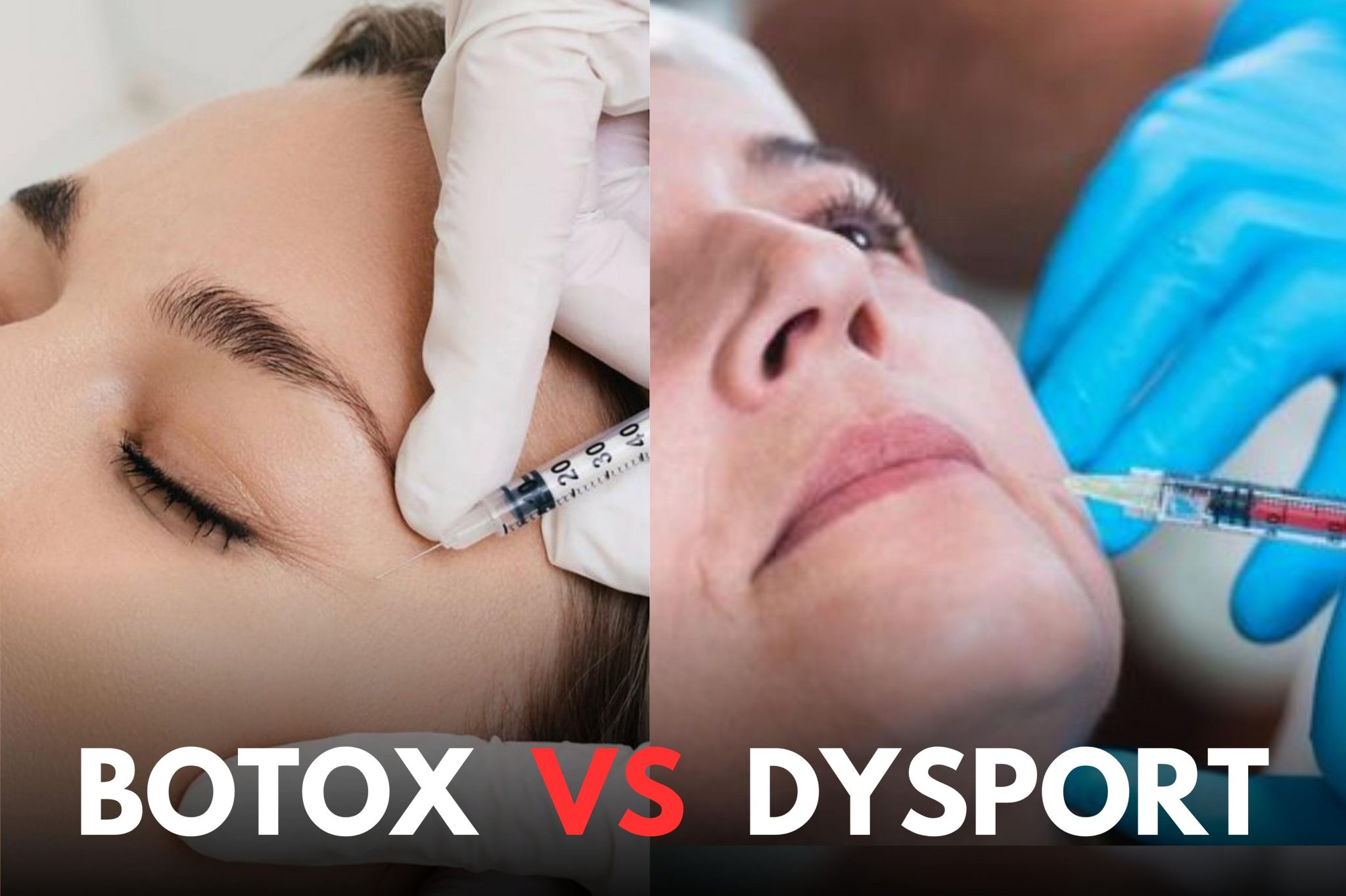 Botox Vs Dysport For Glabellar Lines - Fitness Beauty Art
