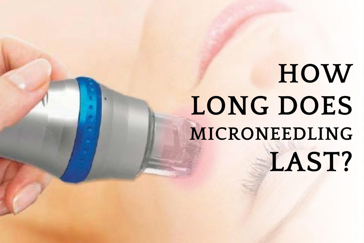 How Long Does Microneedling Last - Fitness Beauty Art