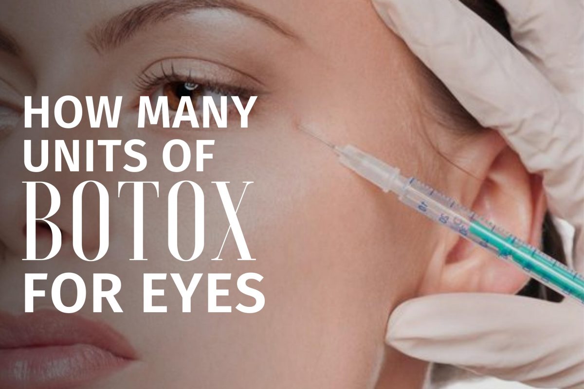 How Many Units Of Botox For Eyes - Fitness Beauty Art