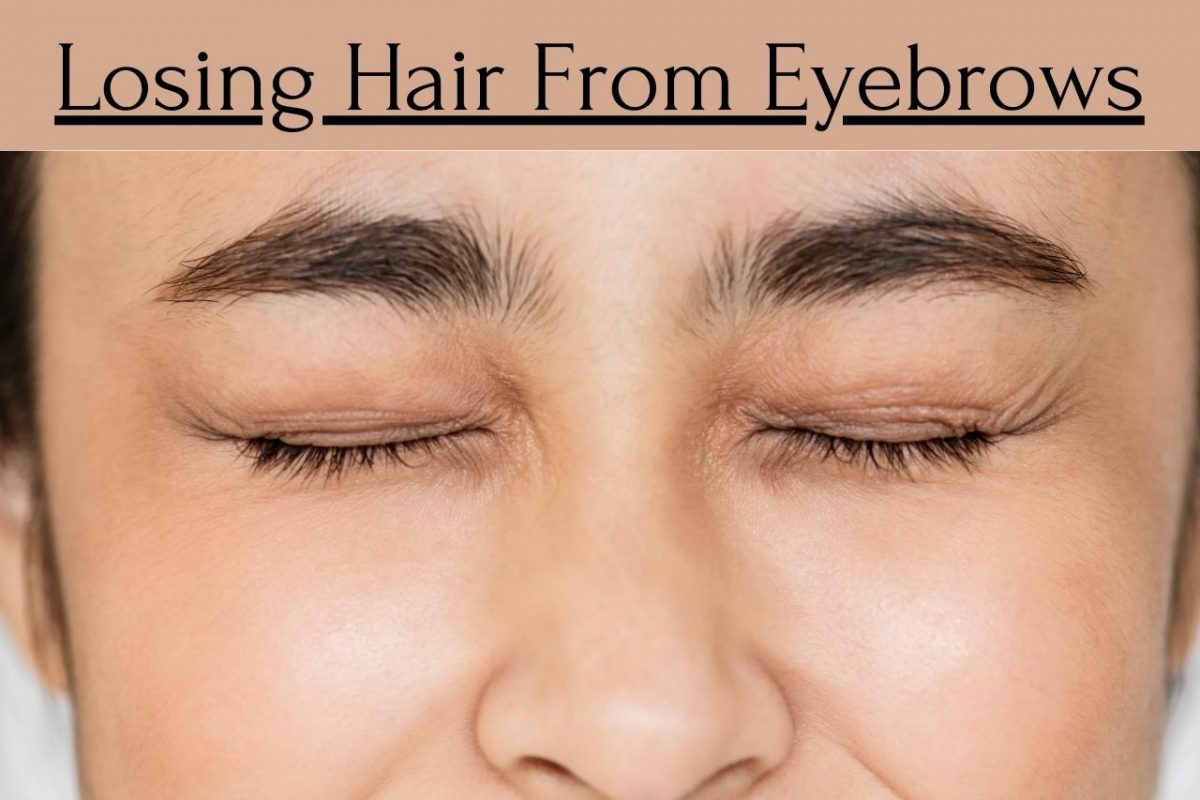Losing Hair From Eyebrows - Fitness Beauty Art
