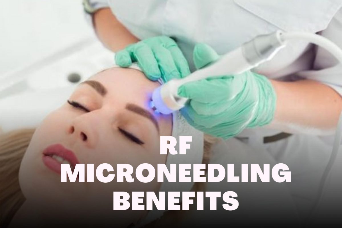 Rf Microneedling Benefits - Fitness Beauty Art