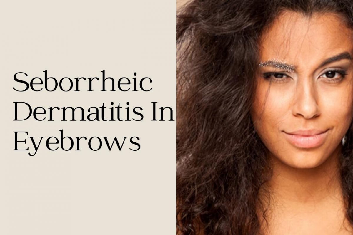 Seborrheic Dermatitis In Eyebrows - Fitness Beauty Art